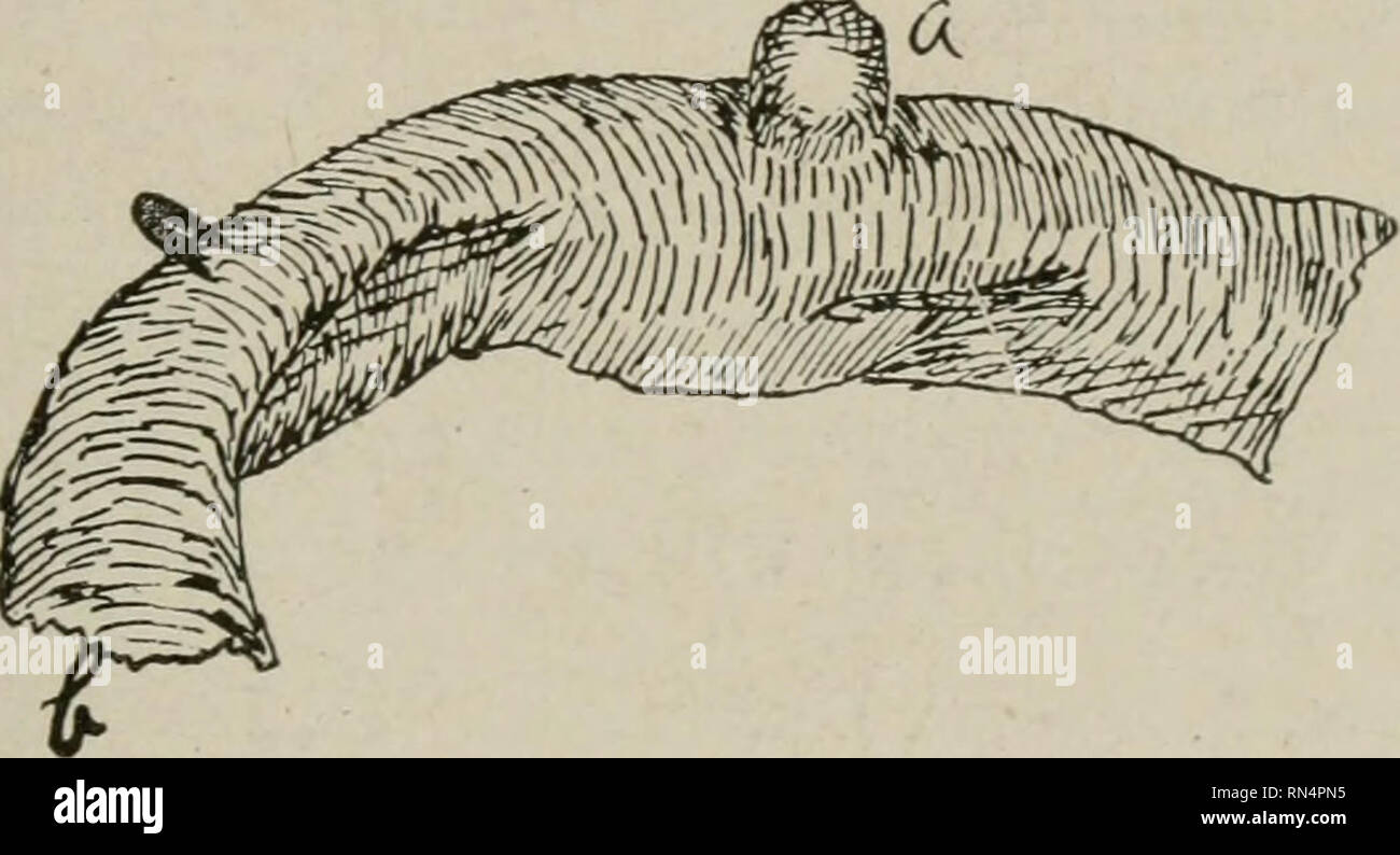 Pus filled cyst hi-res stock photography and images - Alamy