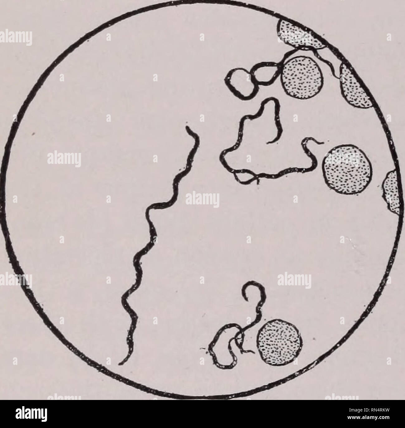 Yaws High Resolution Stock Photography and Images - Alamy