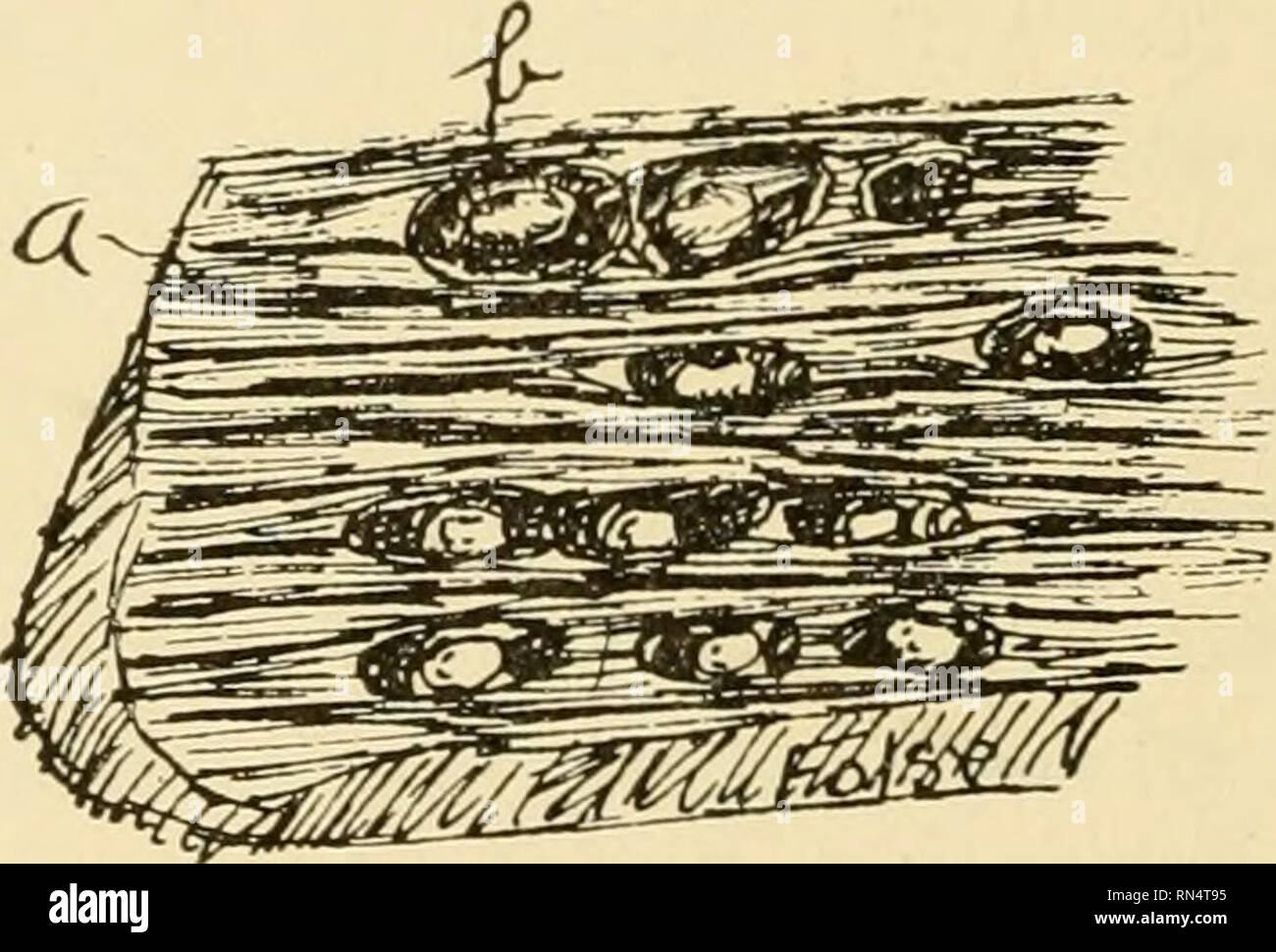 Mucous cyst hi-res stock photography and images - Alamy