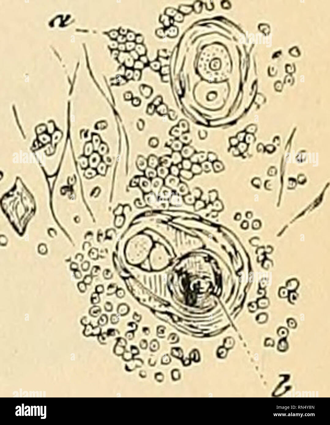 Thymus gland cortex hi-res stock photography and images - Alamy