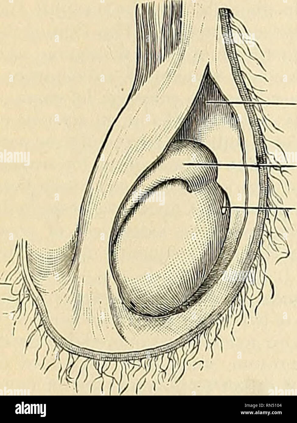 Three testicles hi-res stock photography and images - Alamy