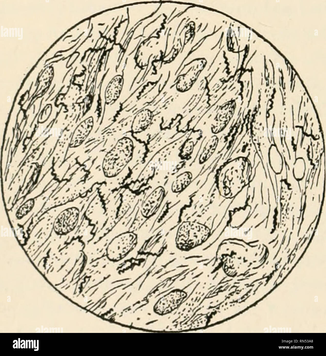 Spirochaetes hi-res stock photography and images - Alamy