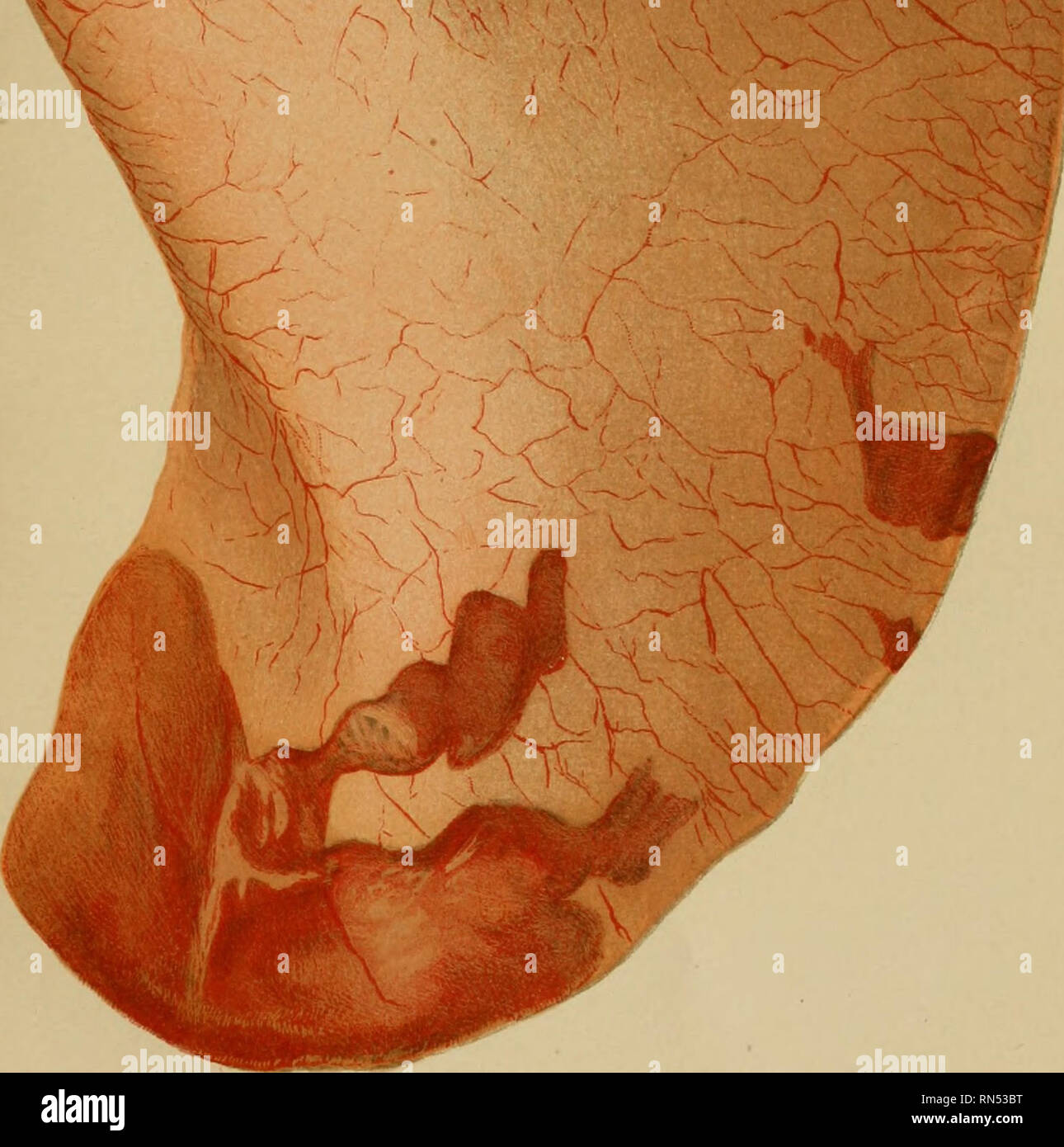 Threadworms hi-res stock photography and images - Alamy