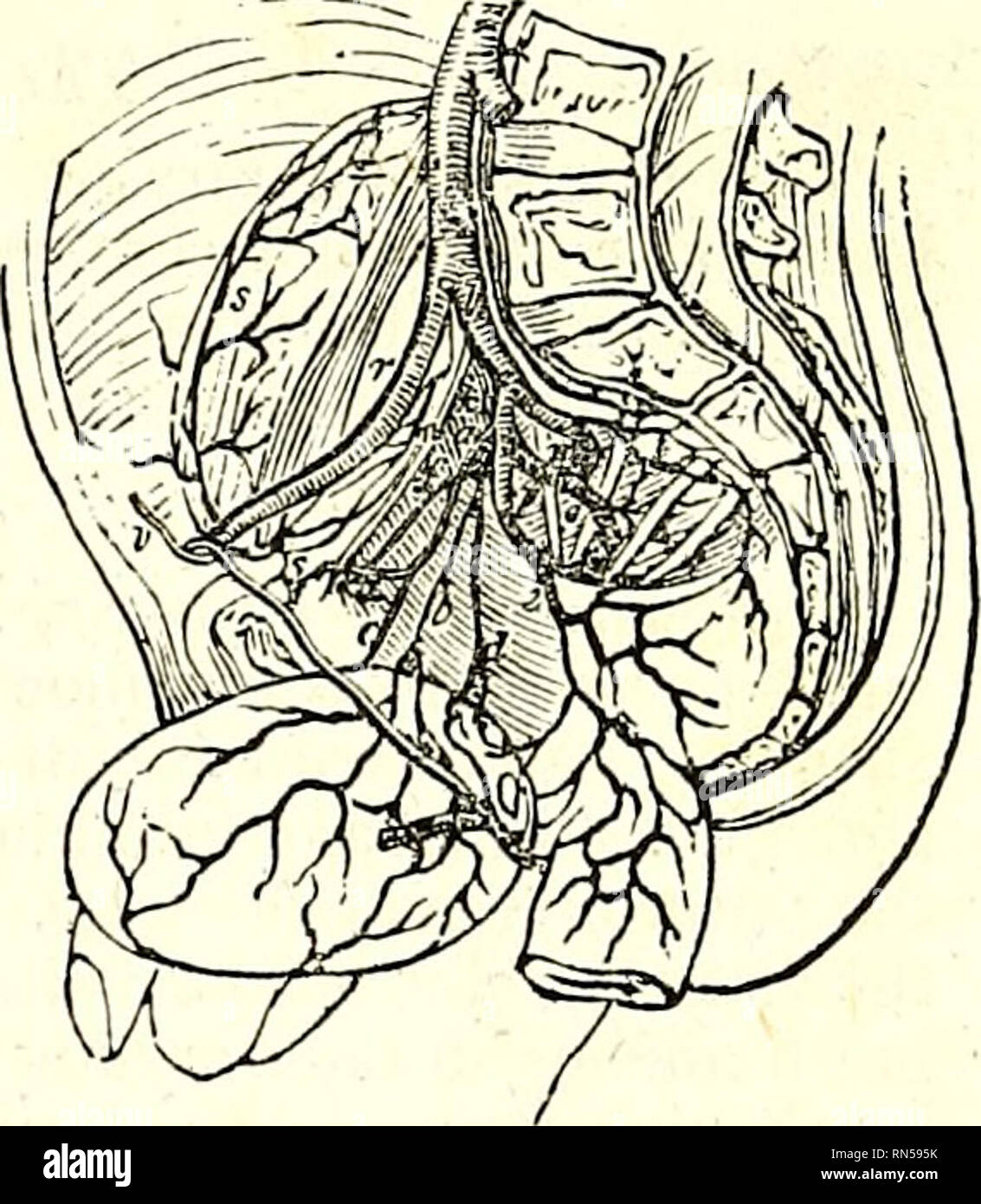 Common iliac vessels hi-res stock photography and images - Alamy