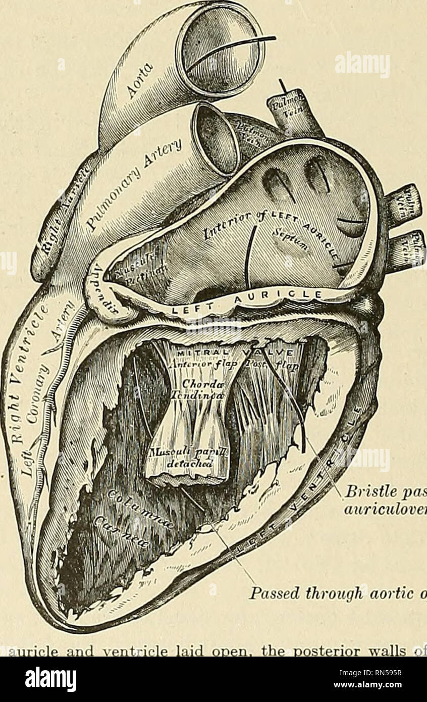Posterior Interventricular Groove