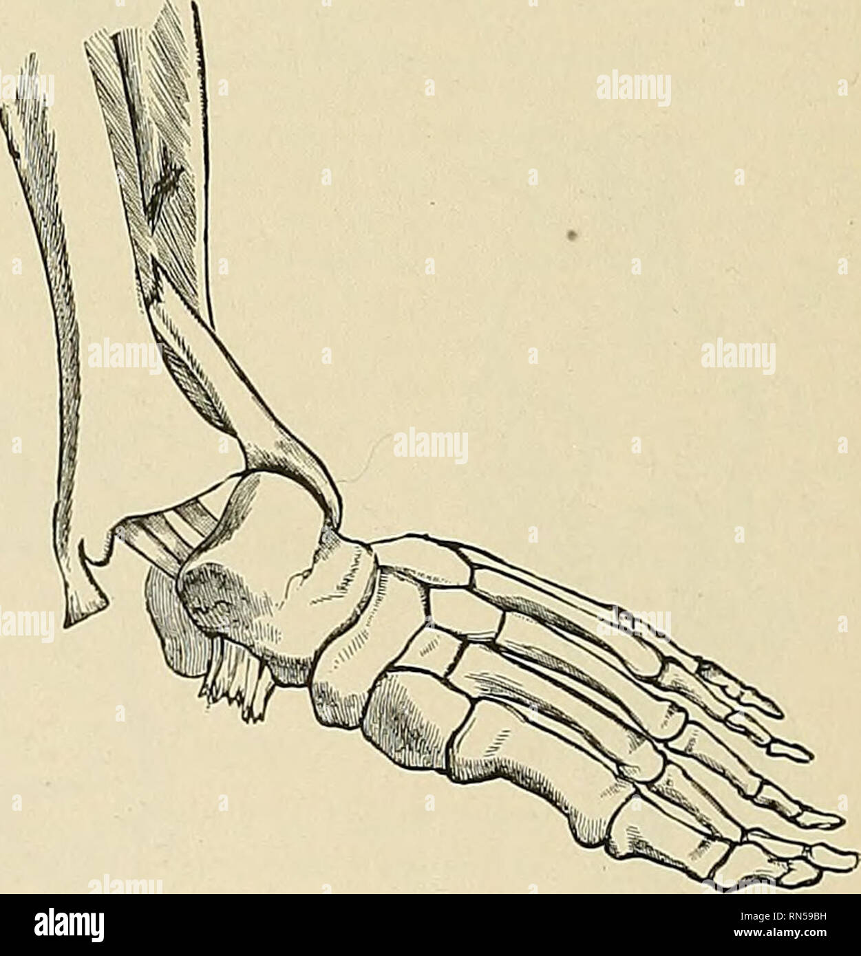 . Anatomy, descriptive and applied. Anatomy. Fig. 406.—Fracture of the ...