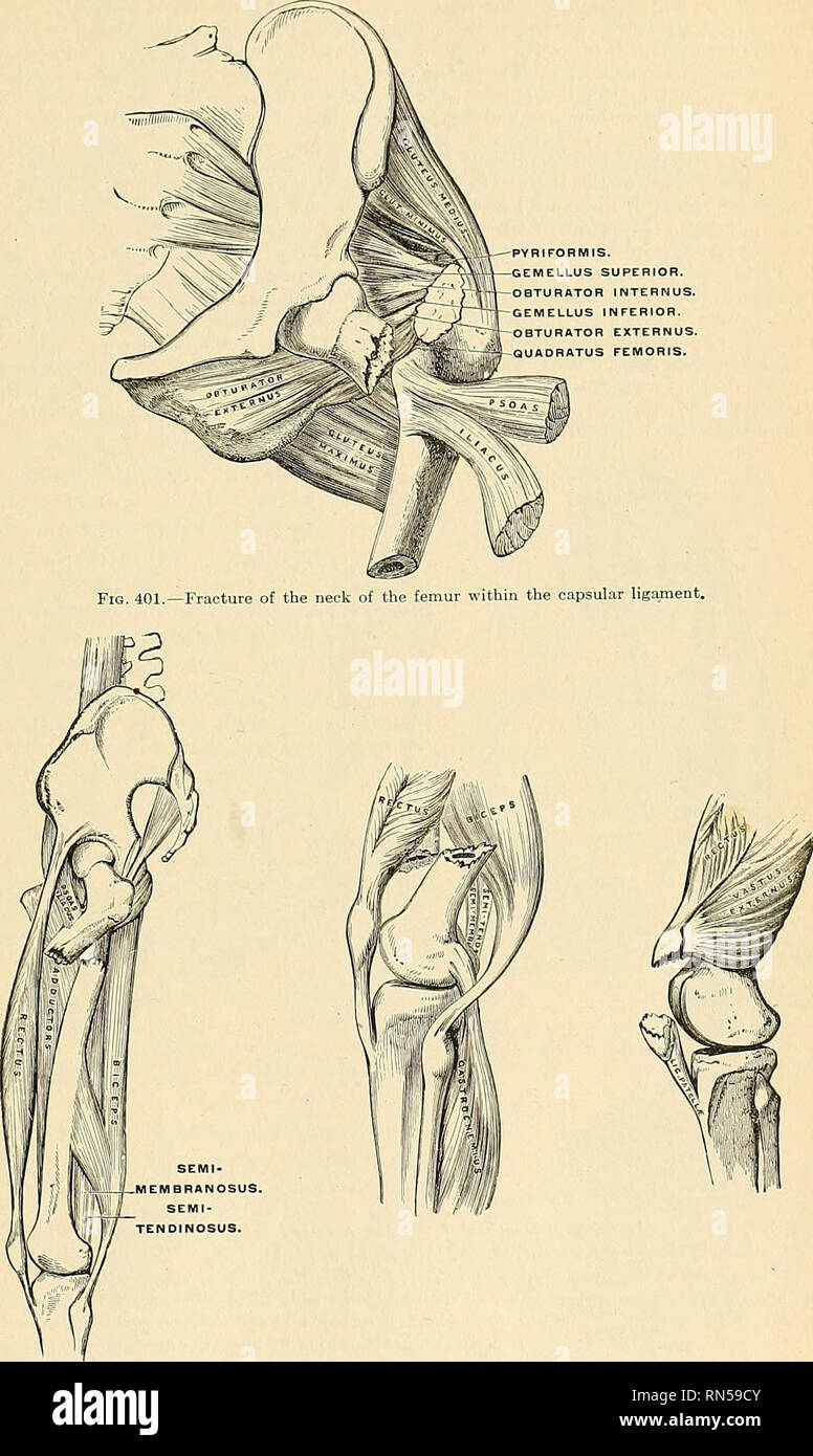 Gastrocnemius and popliteal muscles hi-res stock photography and images ...