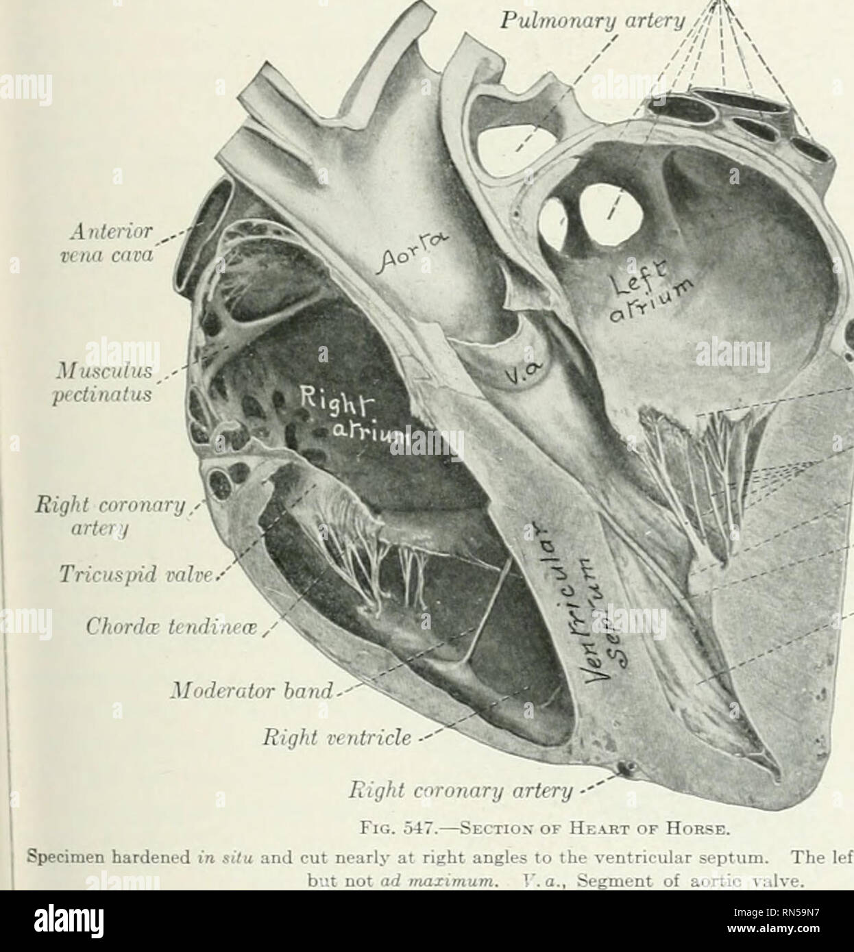 Interatrial Septum