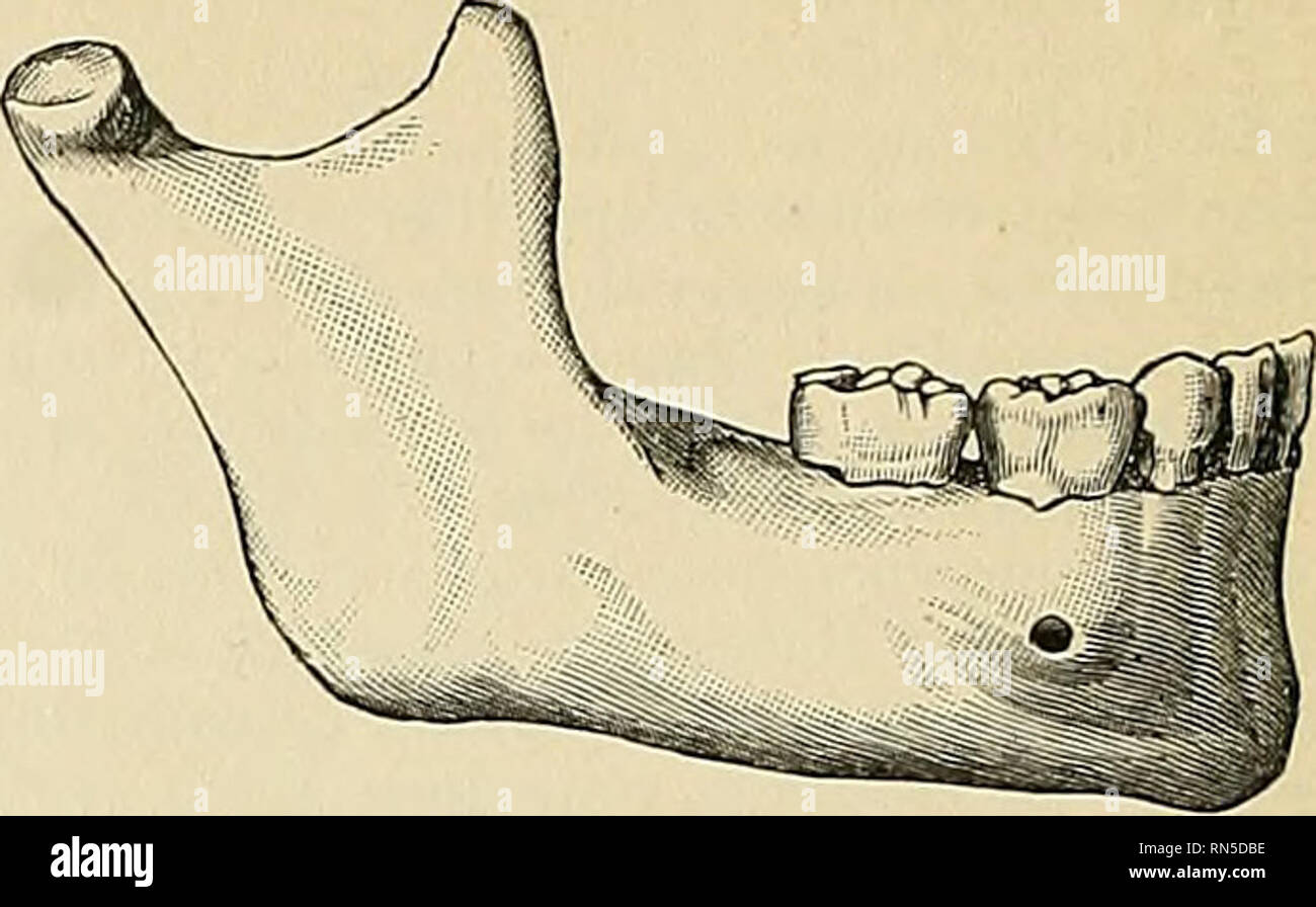 . Anatomy, descriptive and applied. Anatomy. Fig. 90.—Mandible in ...