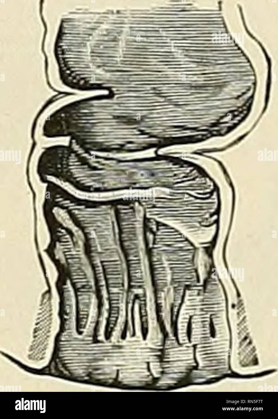 . Anatomy, descriptive and applied. Anatomy. Fig. 1069.—Diagram of ...