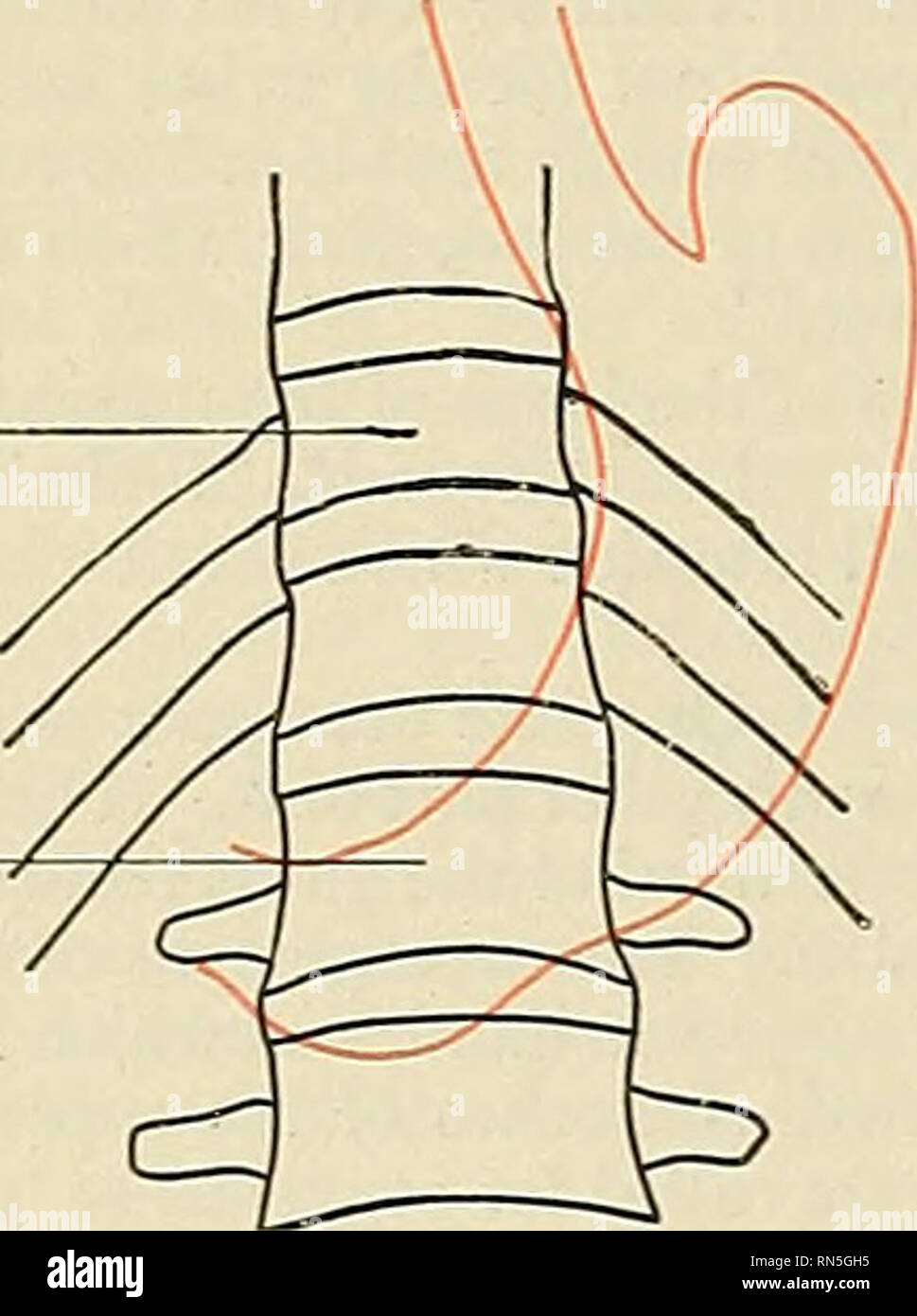 Bowel loops hi-res stock photography and images - Alamy