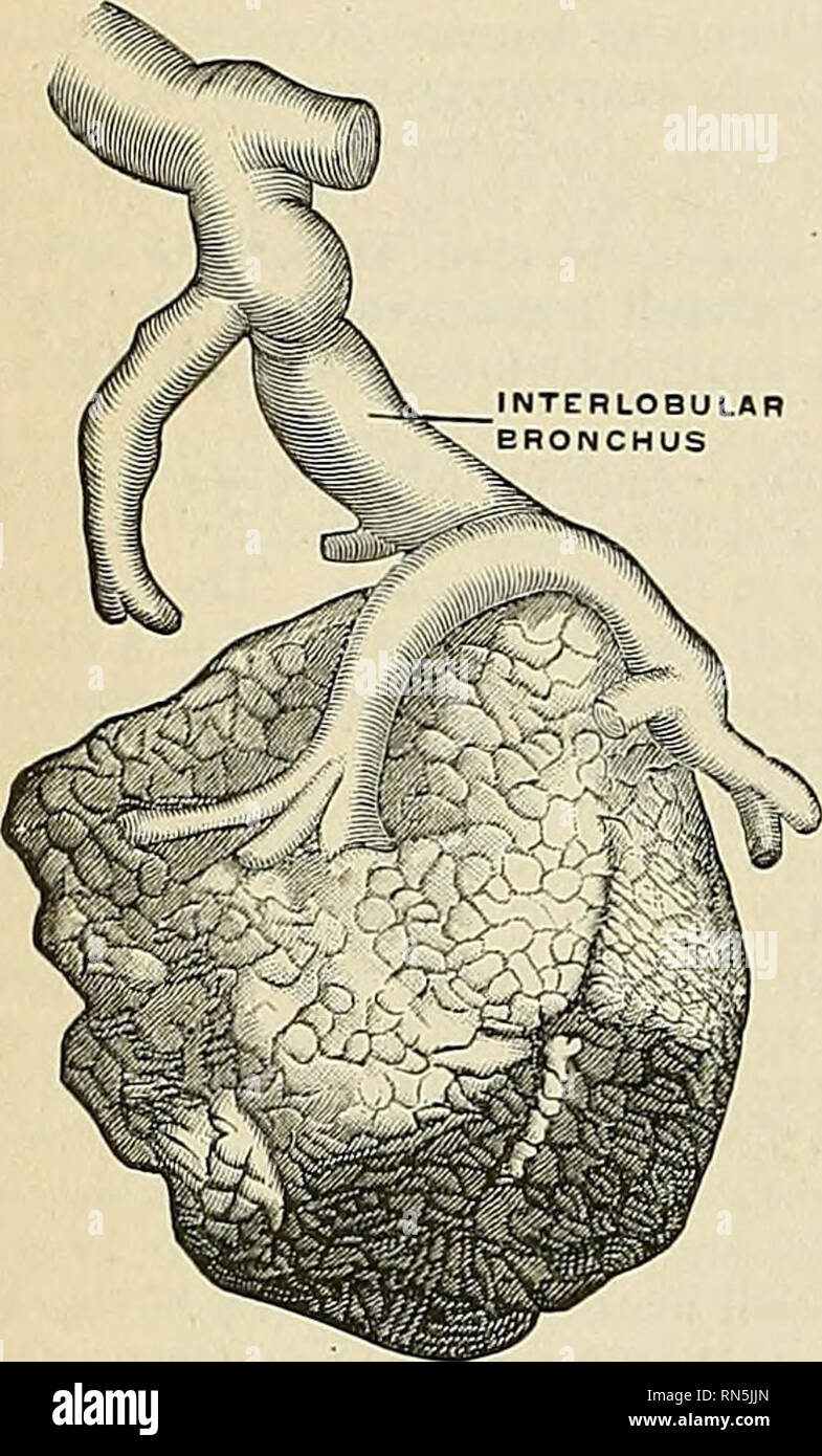 Bronchi bronchial tubes hi-res stock photography and images - Alamy