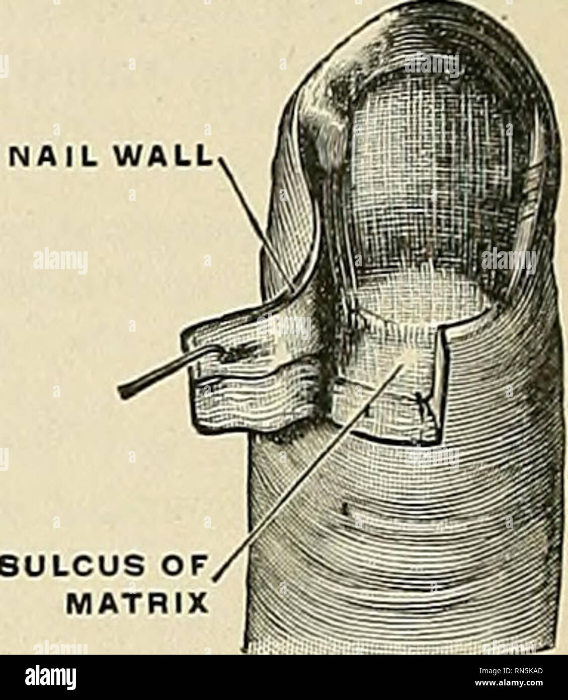 Nail anatomy matrix hi-res stock photography and images - Alamy