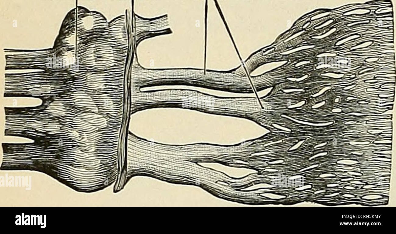 Membrane reissner hi-res stock photography and images - Alamy