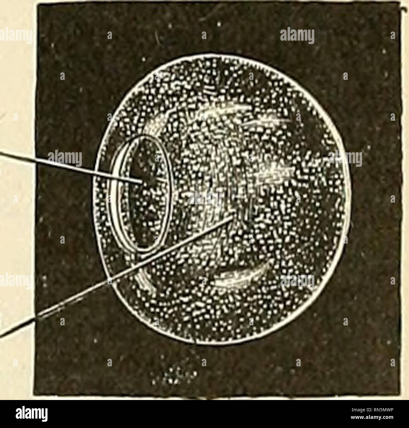 Optic nerve papilla hi-res stock photography and images - Alamy