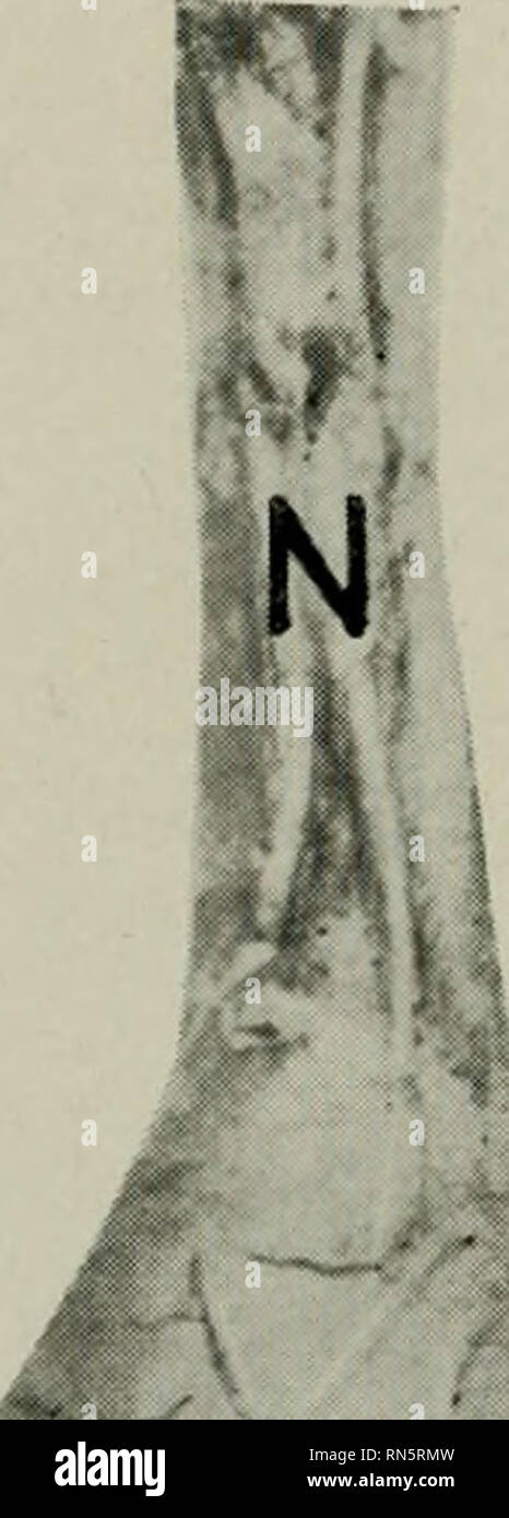 Ram testicles not bird hi-res stock photography and images - Alamy