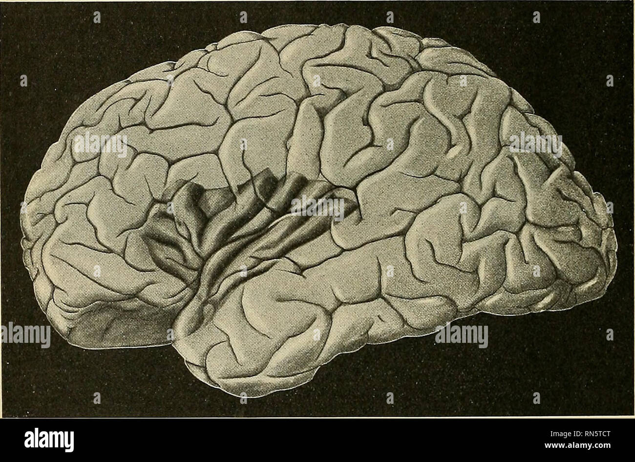 Insular in the brain hi-res stock photography and images - Alamy