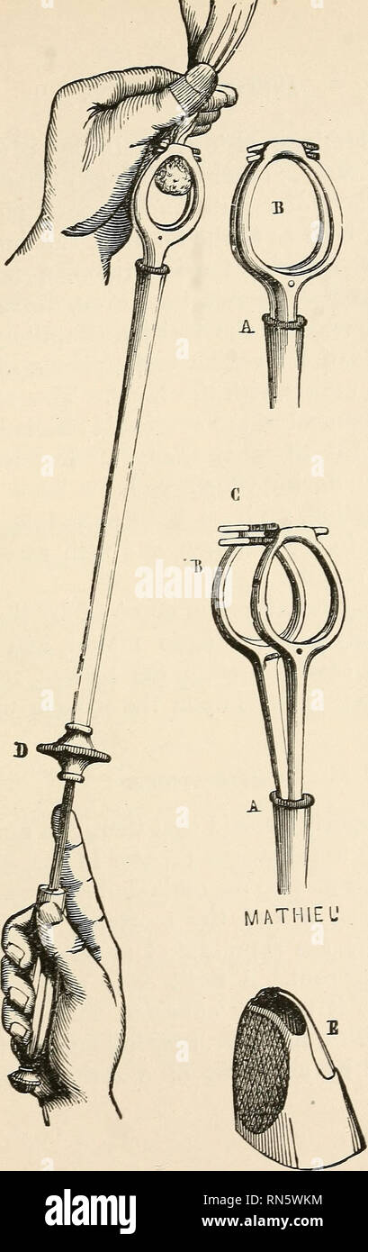 Open castration hi-res stock photography and images - Alamy