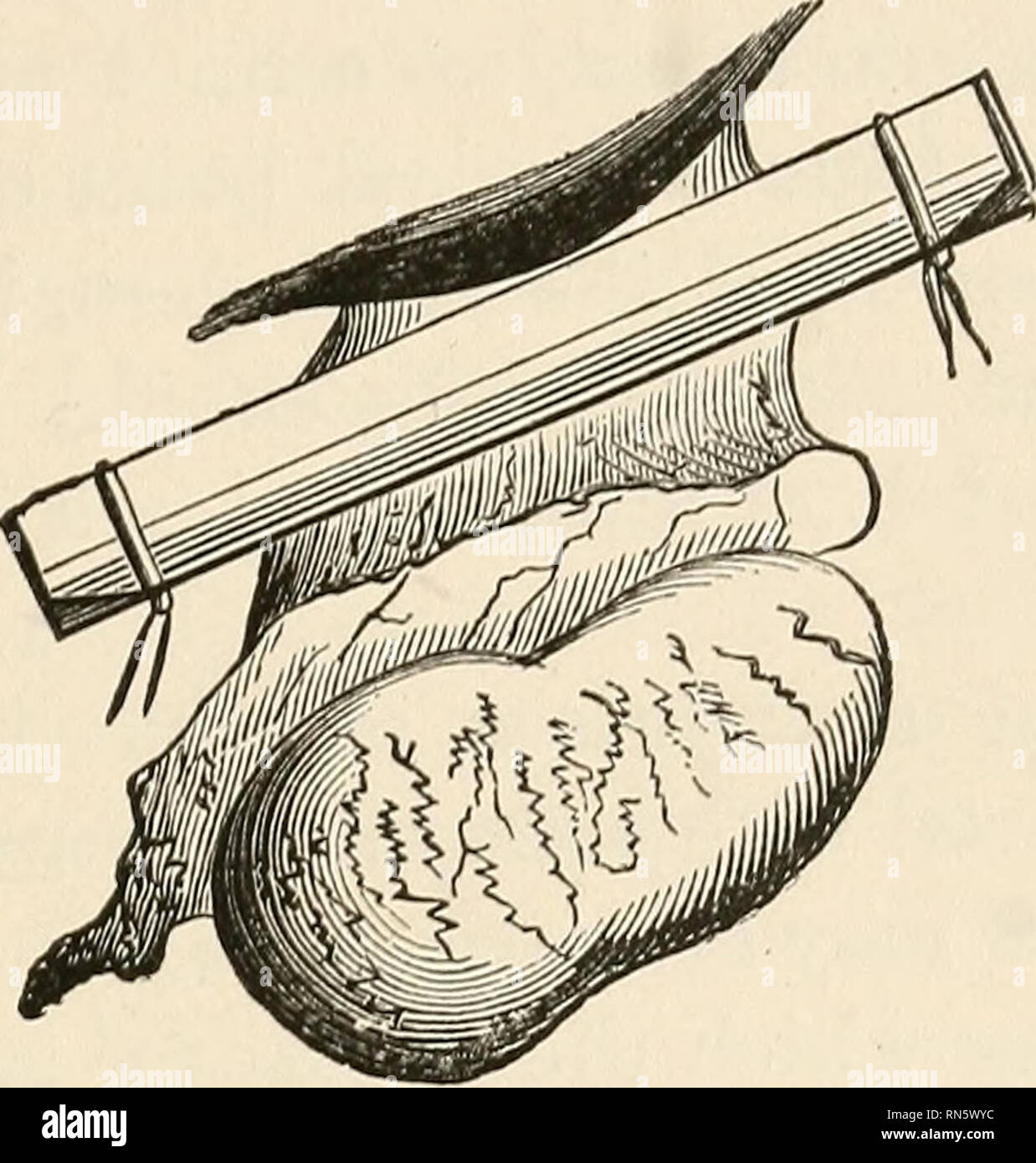 Inguinal testicles hi-res stock photography and images - Alamy