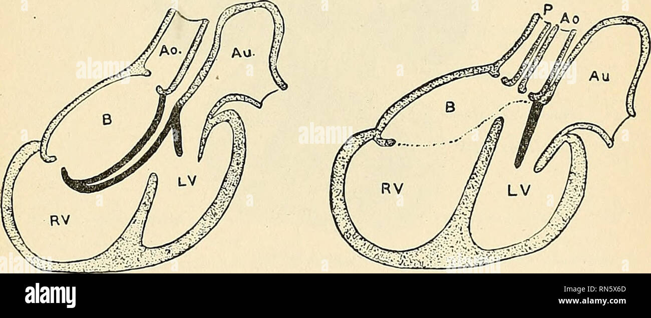 Eustachian valve hi-res stock photography and images - Alamy