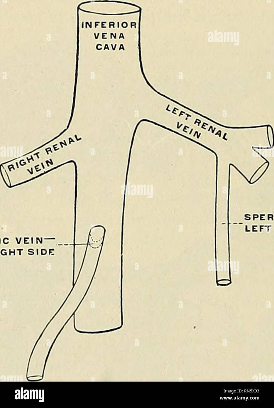 Common iliac vessels hi-res stock photography and images - Alamy