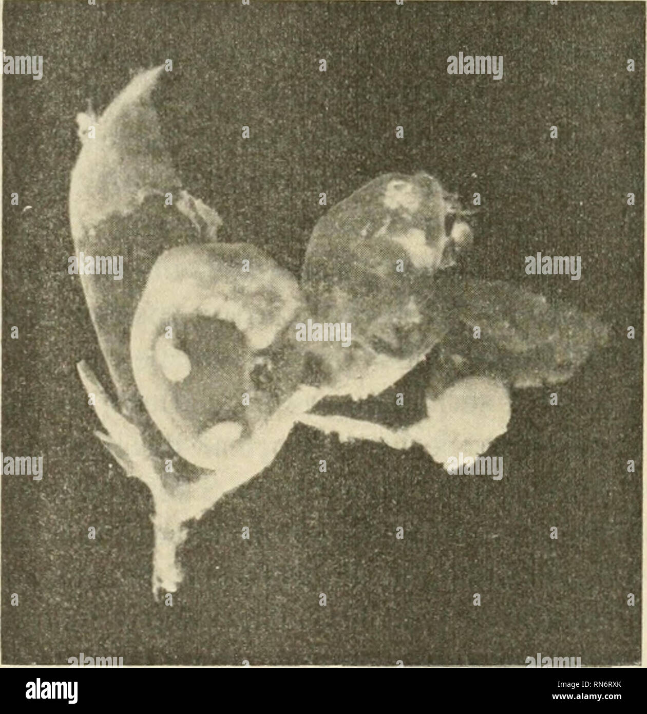 Mesothelial layer hi-res stock photography and images - Alamy