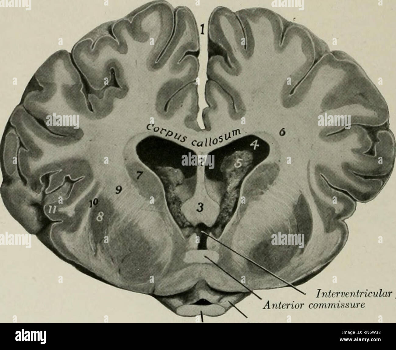 Corpus callosum fibers hi-res stock photography and images - Alamy