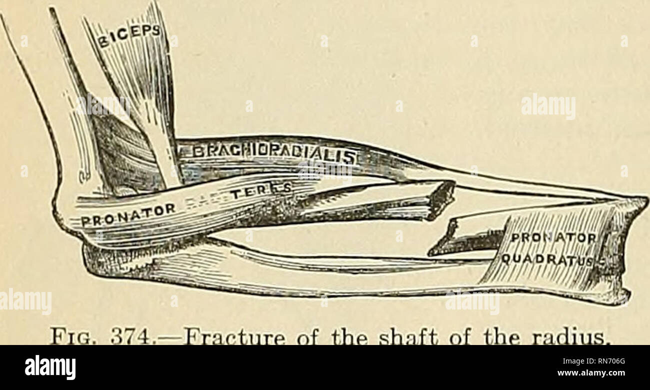 Deep muscles of forearm hi-res stock photography and images - Alamy