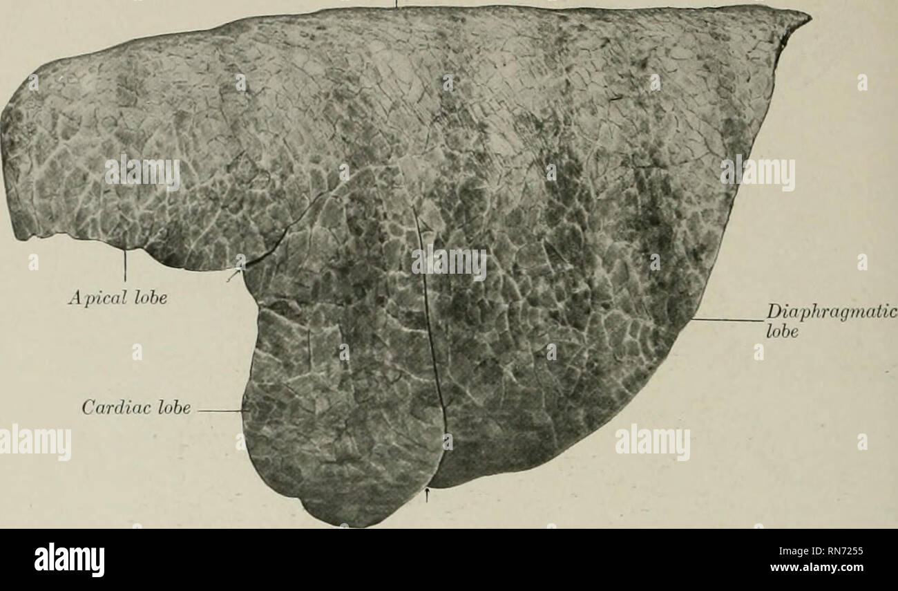 Cardiac notch hi-res stock photography and images - Alamy