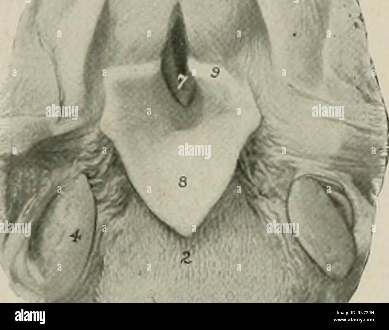Tonsil membrane hi-res stock photography and images - Alamy