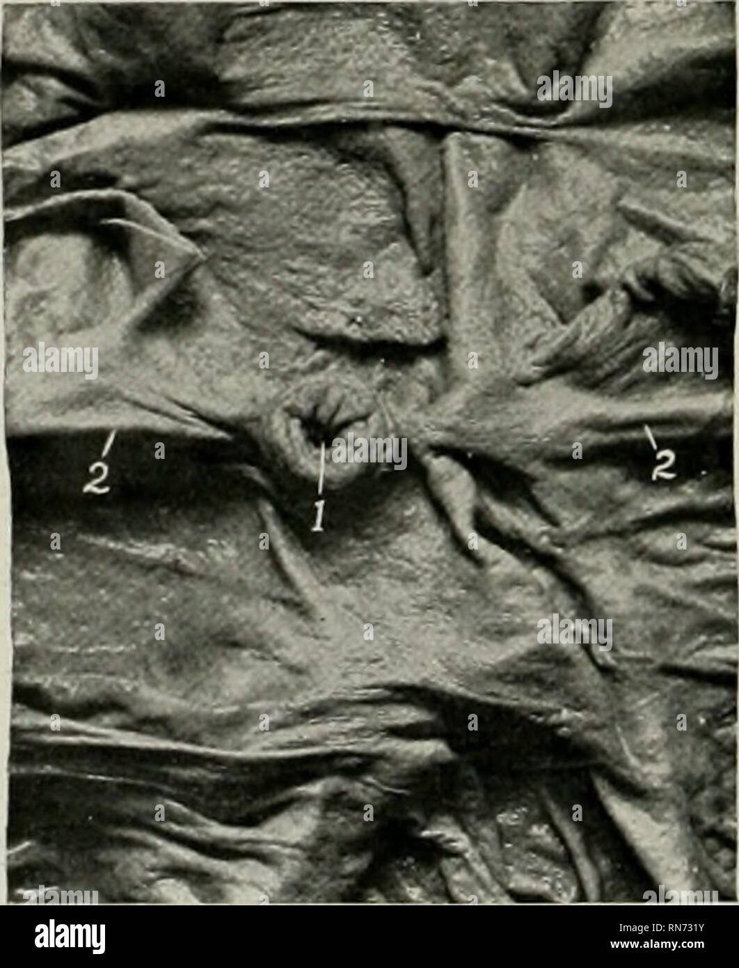 Pig kidney anatomy hi-res stock photography and images - Alamy