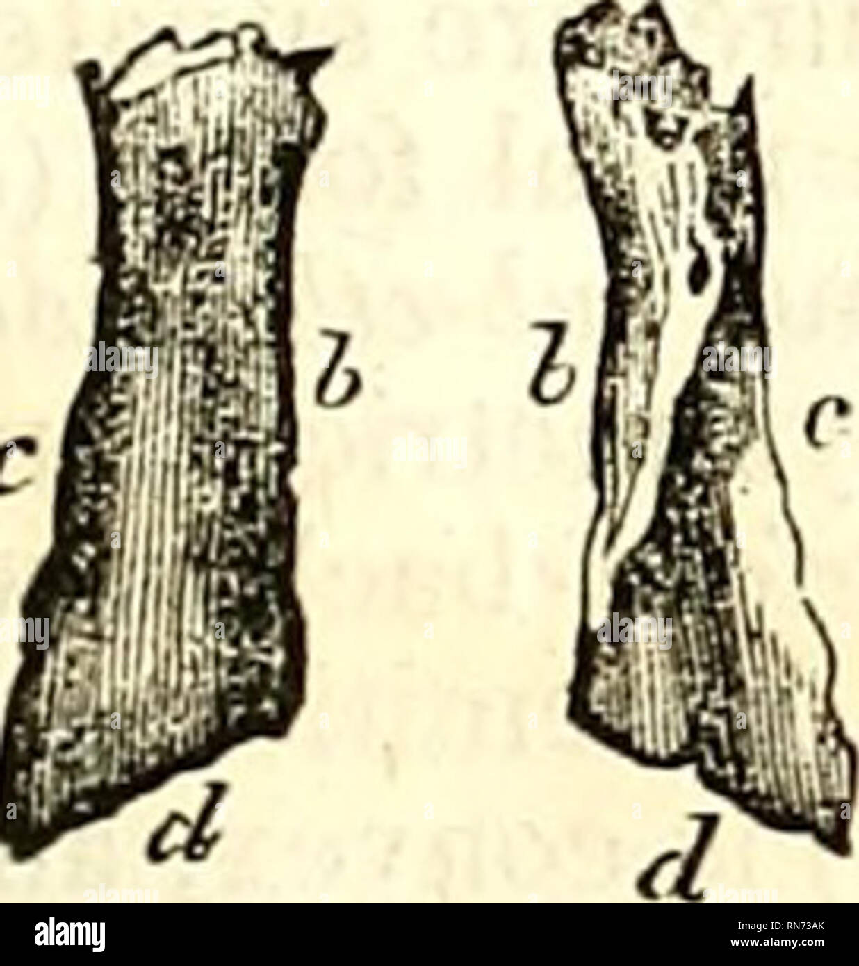 . The anatomy of the human body. Human anatomy; Anatomy. NASAL BONES ...