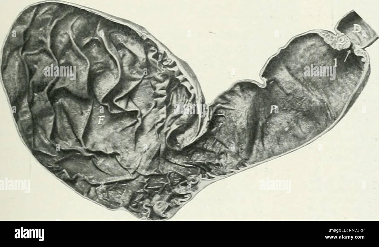 The omasum hi-res stock photography and images - Alamy