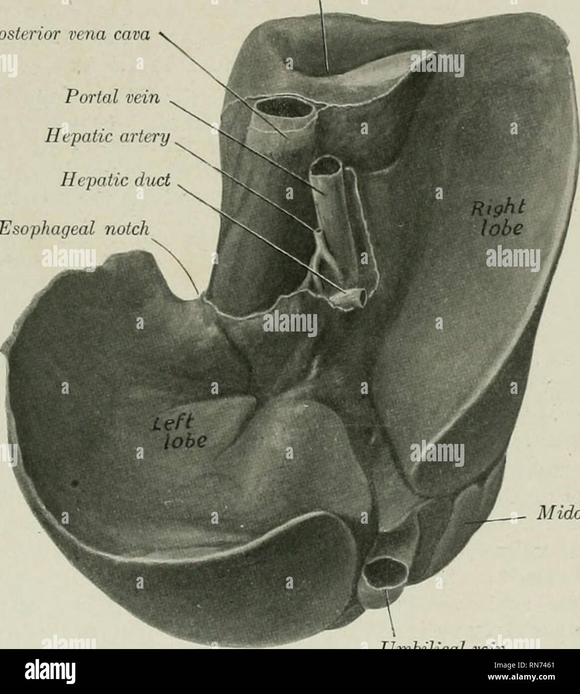 Hepatis hi-res stock photography and images - Alamy