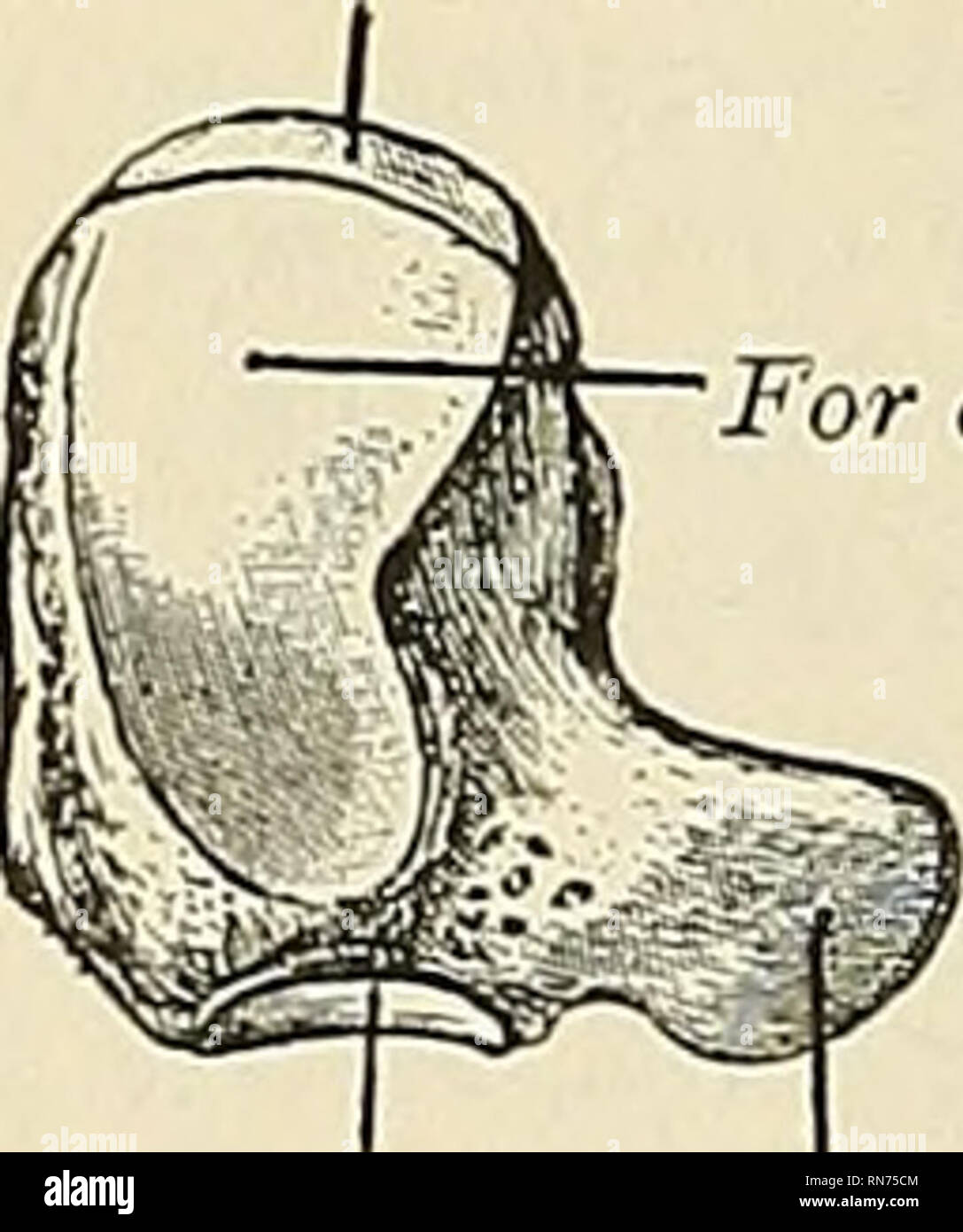 . Anatomy, descriptive and applied. Anatomy. For 4th metacarpal Palmar ...