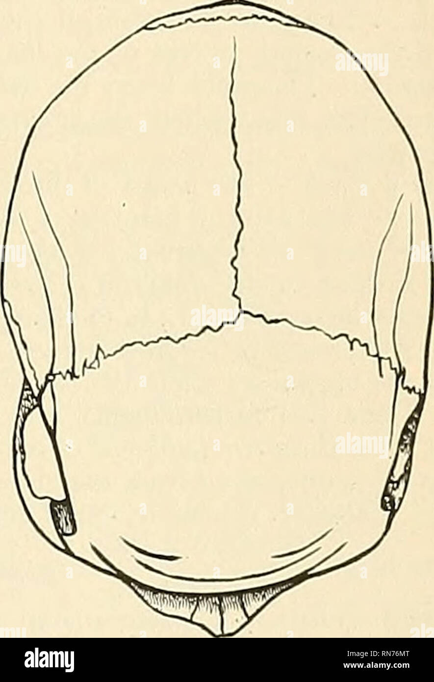 Dolichocephalic hi-res stock photography and images - Alamy