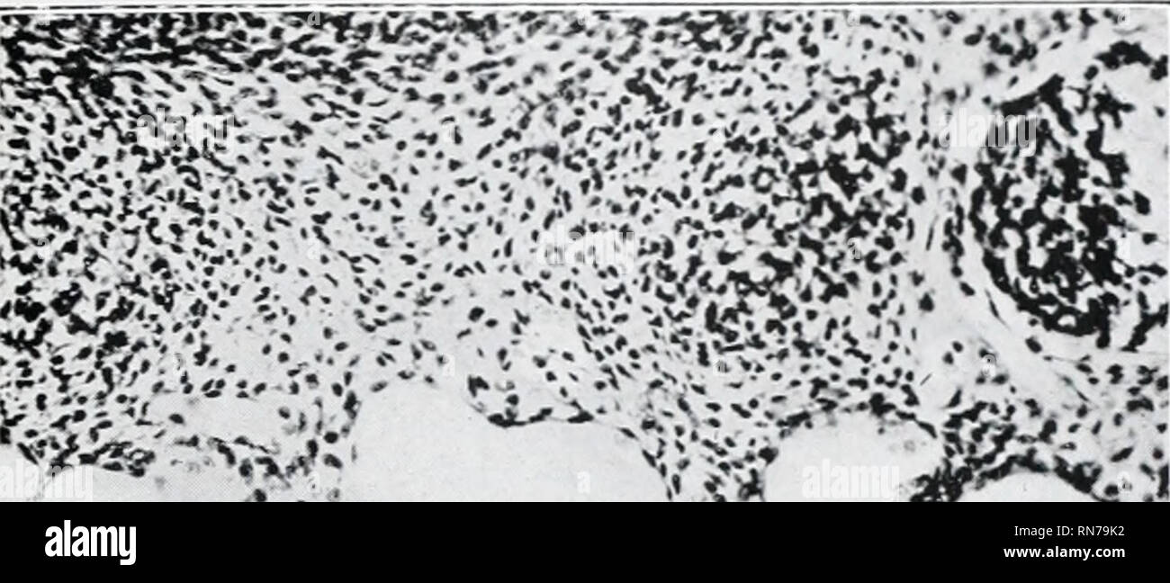. The anatomy and development of the systemic lymphatic vessels in the ...