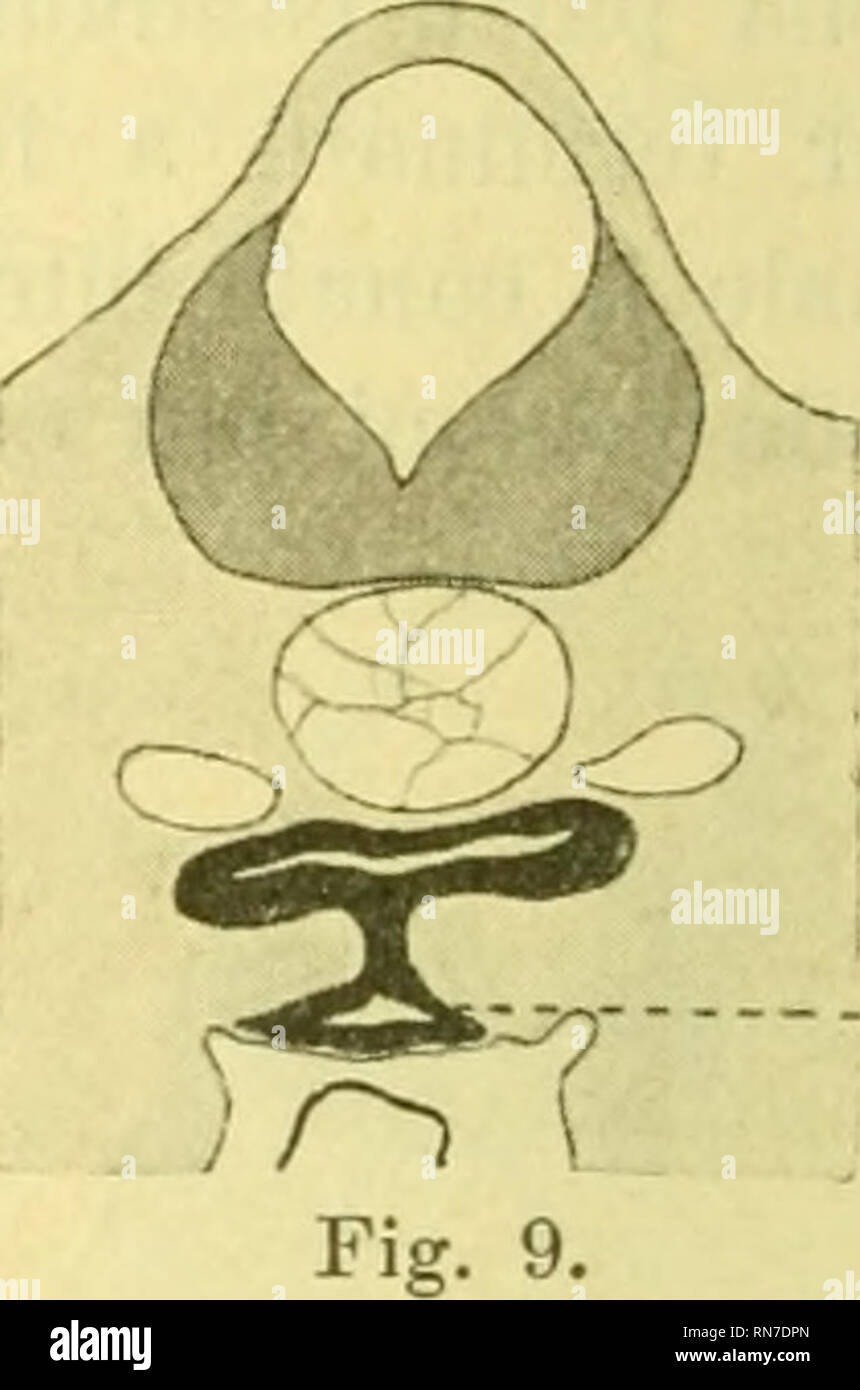 Vescicole hi-res stock photography and images - Alamy