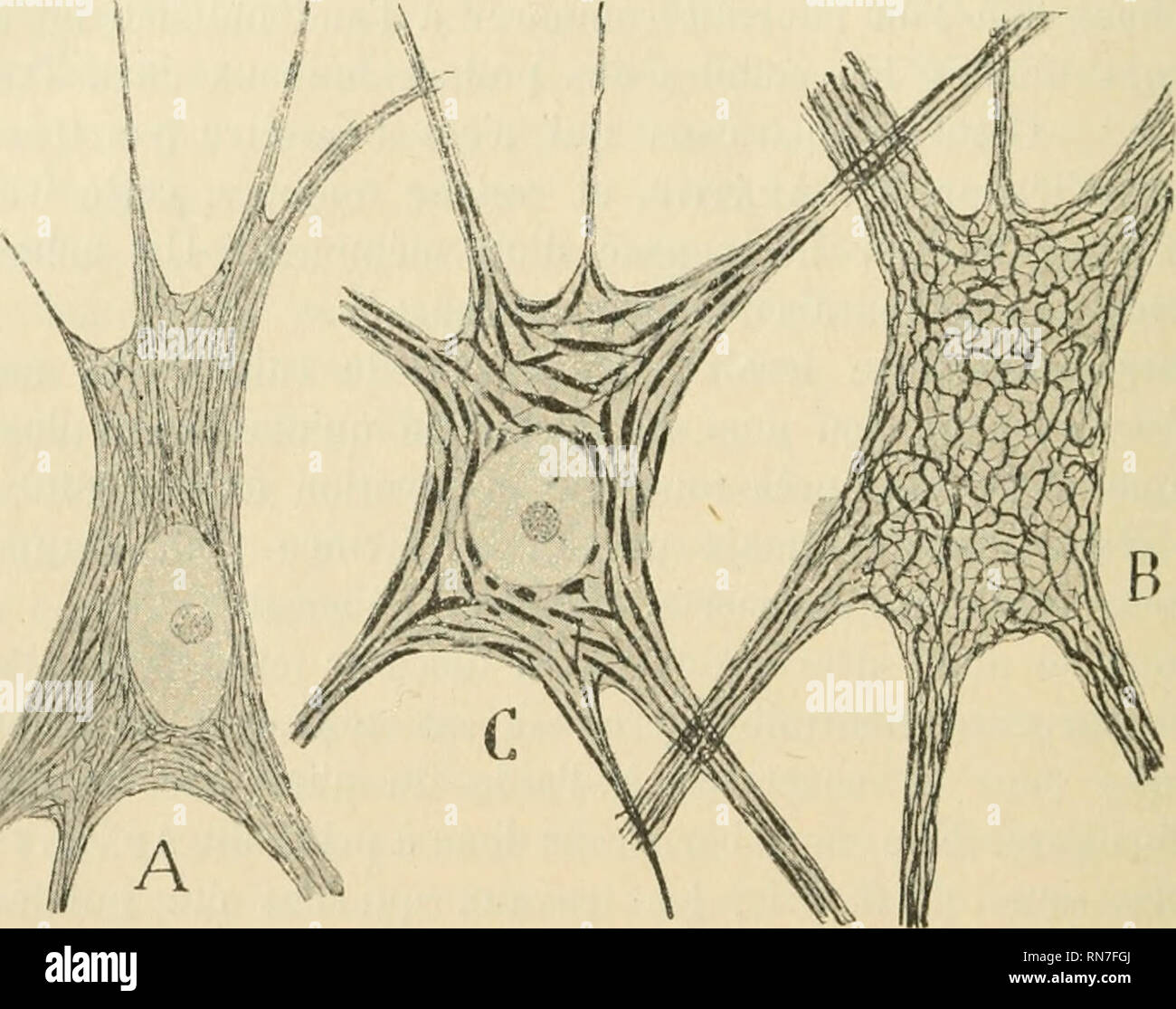 Neurofibrillaire hi-res stock photography and images - Alamy