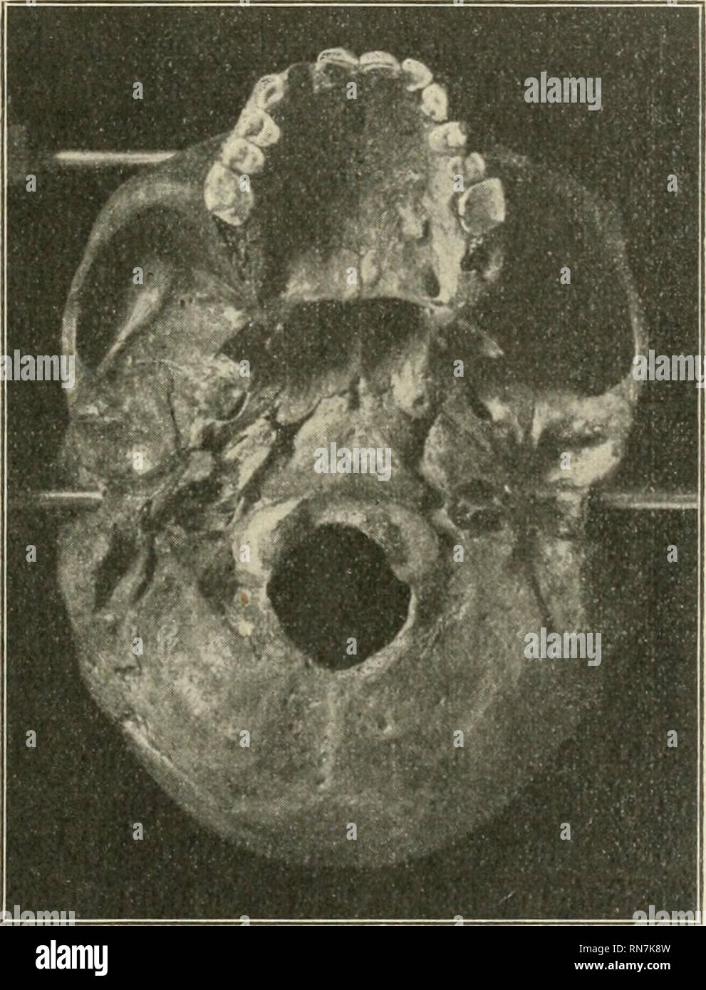 . Anatomischer Anzeiger. Anatomy, Comparative; Anatomy, Comparative ...