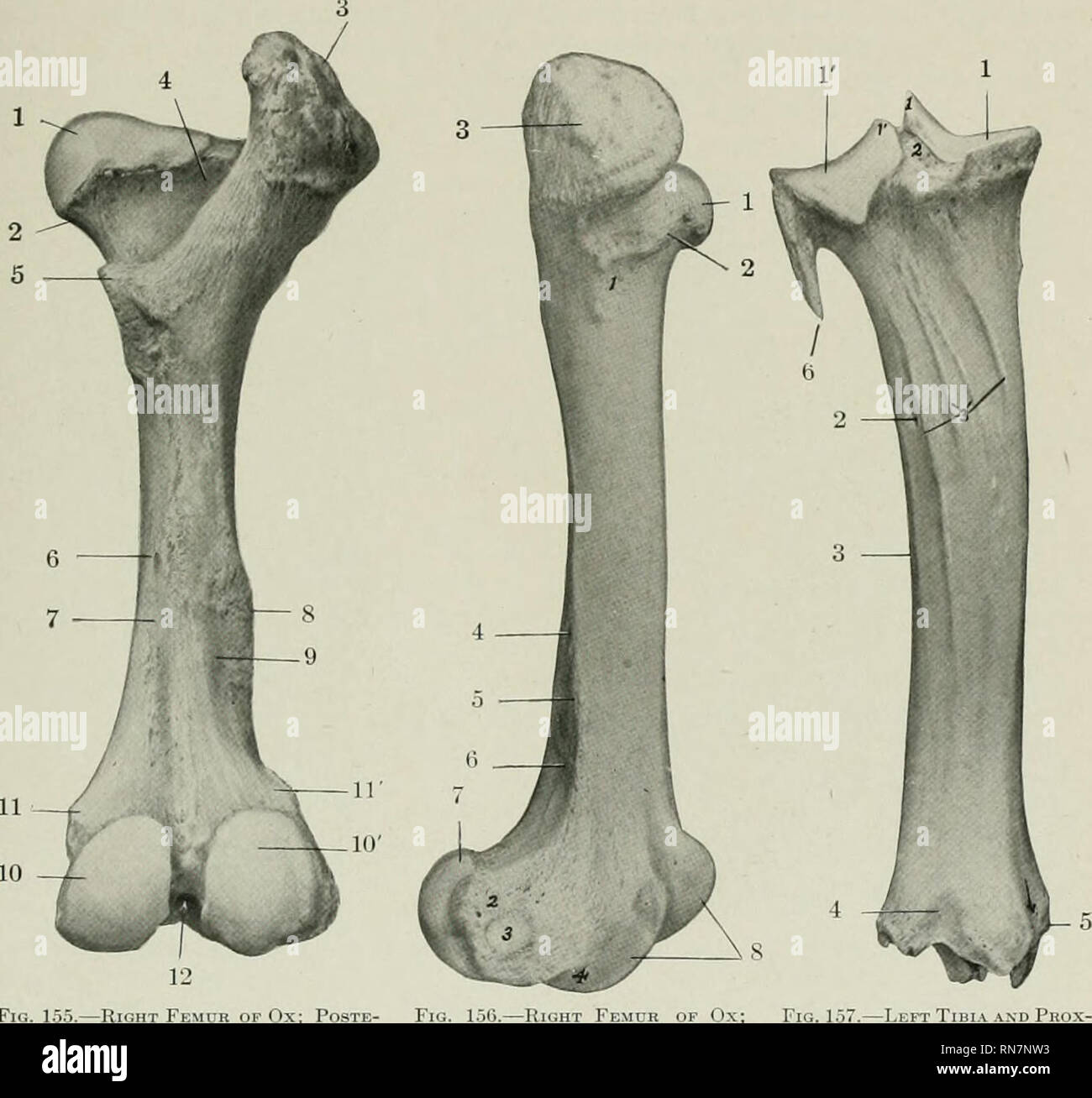 Fovea Capitis Of Femur