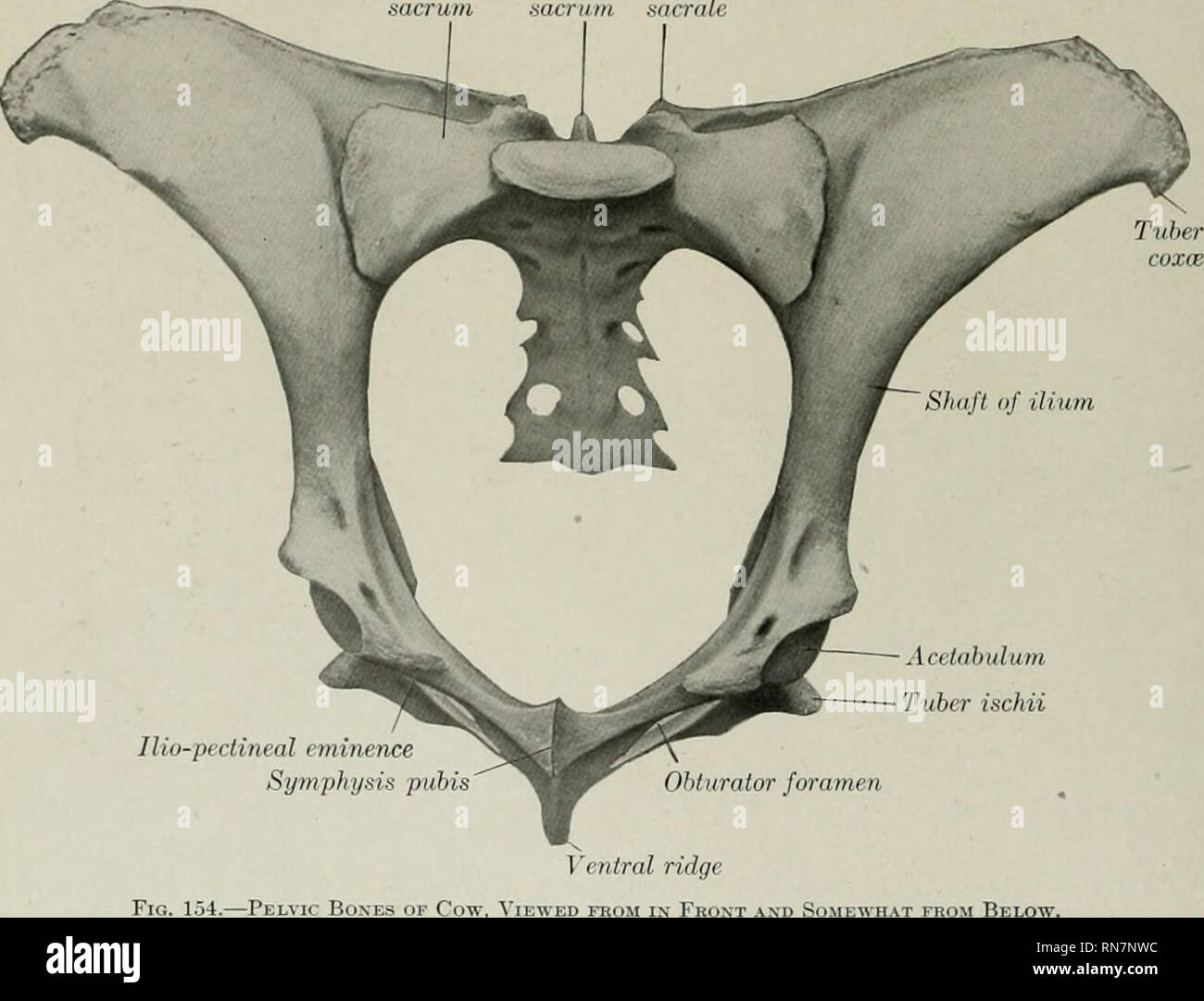 Acetabular notch hi-res stock photography and images - Alamy