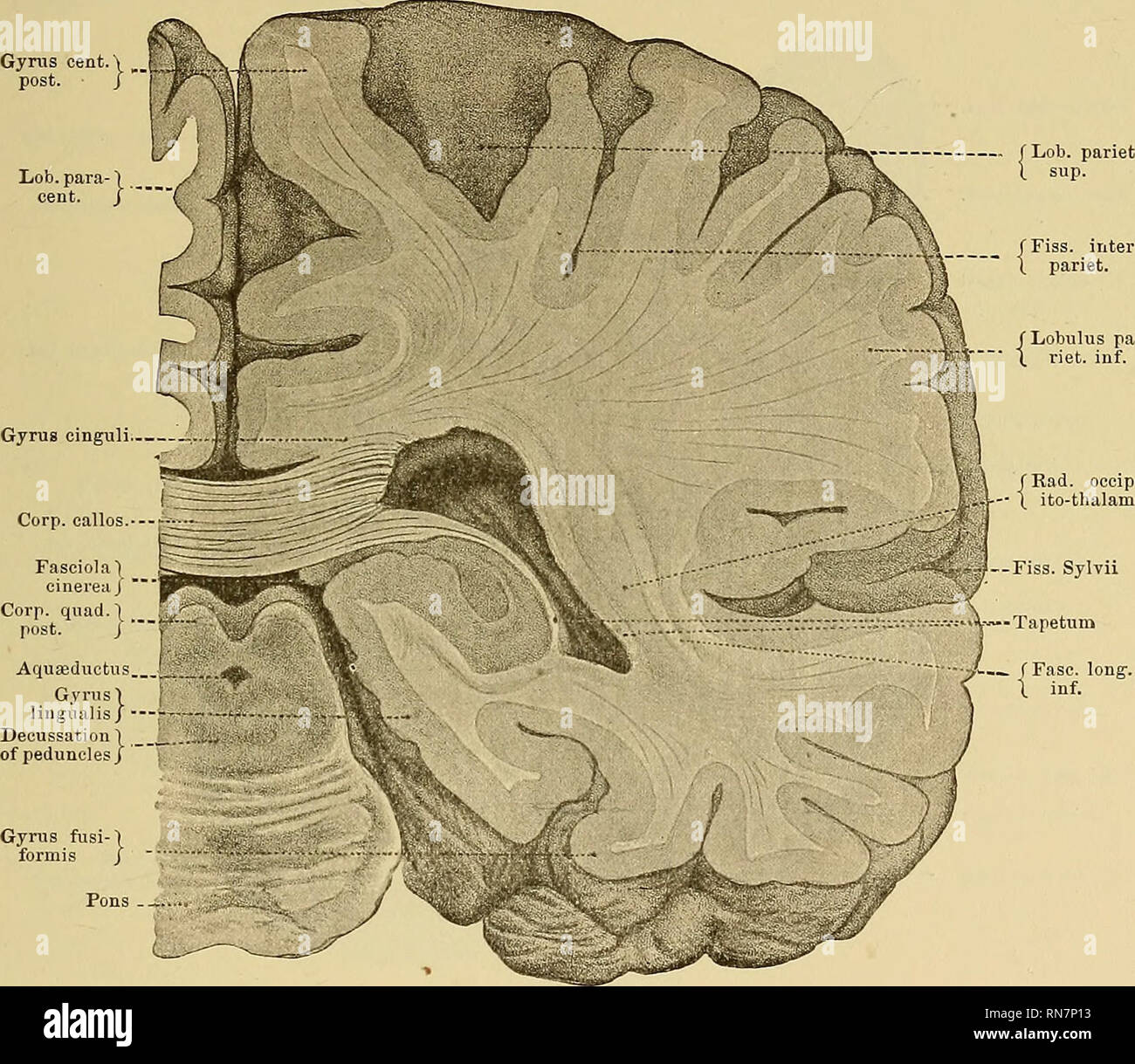 Corpora Quadrigemina Diagram