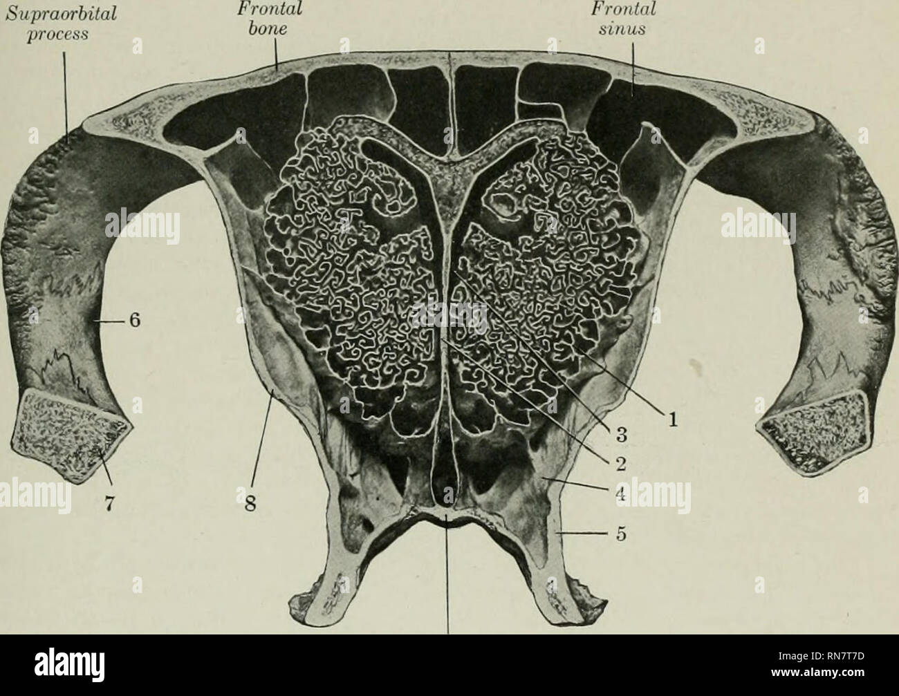 Ethmoid Bone Anatomy
