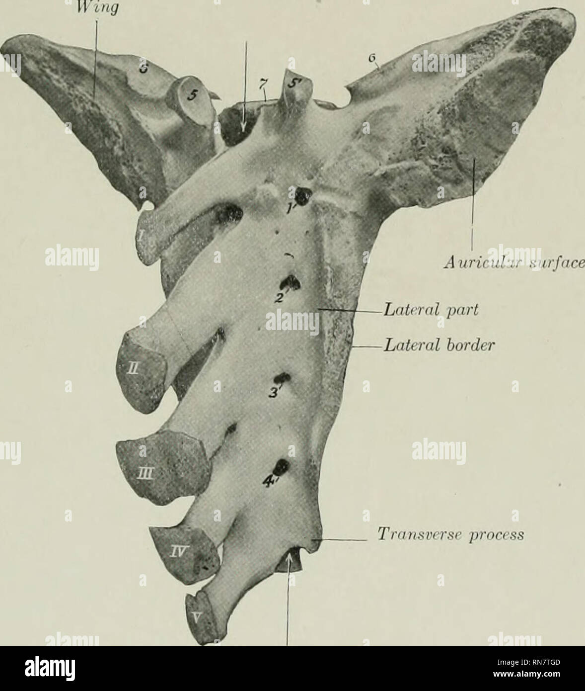 Sacrum Anatomy 34496 Sacral Erector Spinae Plane Block For Sacral Soft