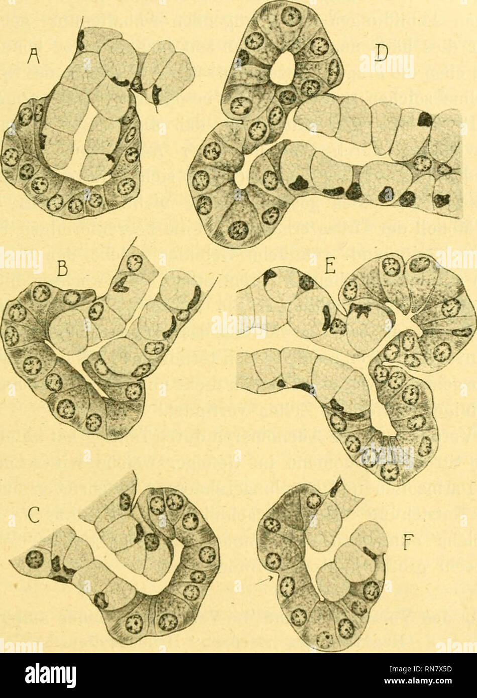 Adenomere hi-res stock photography and images - Alamy