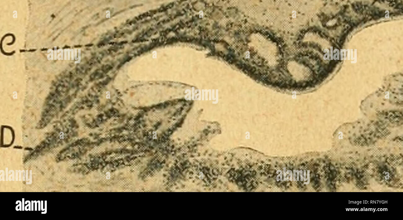 Anatomischer lappen hi-res stock photography and images - Alamy