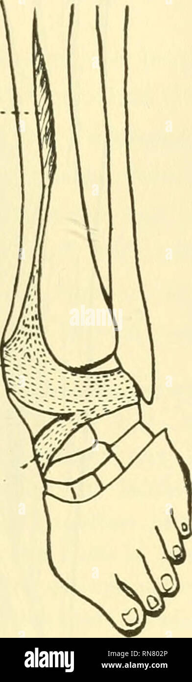 Fusswurzelknochen hi-res stock photography and images - Alamy