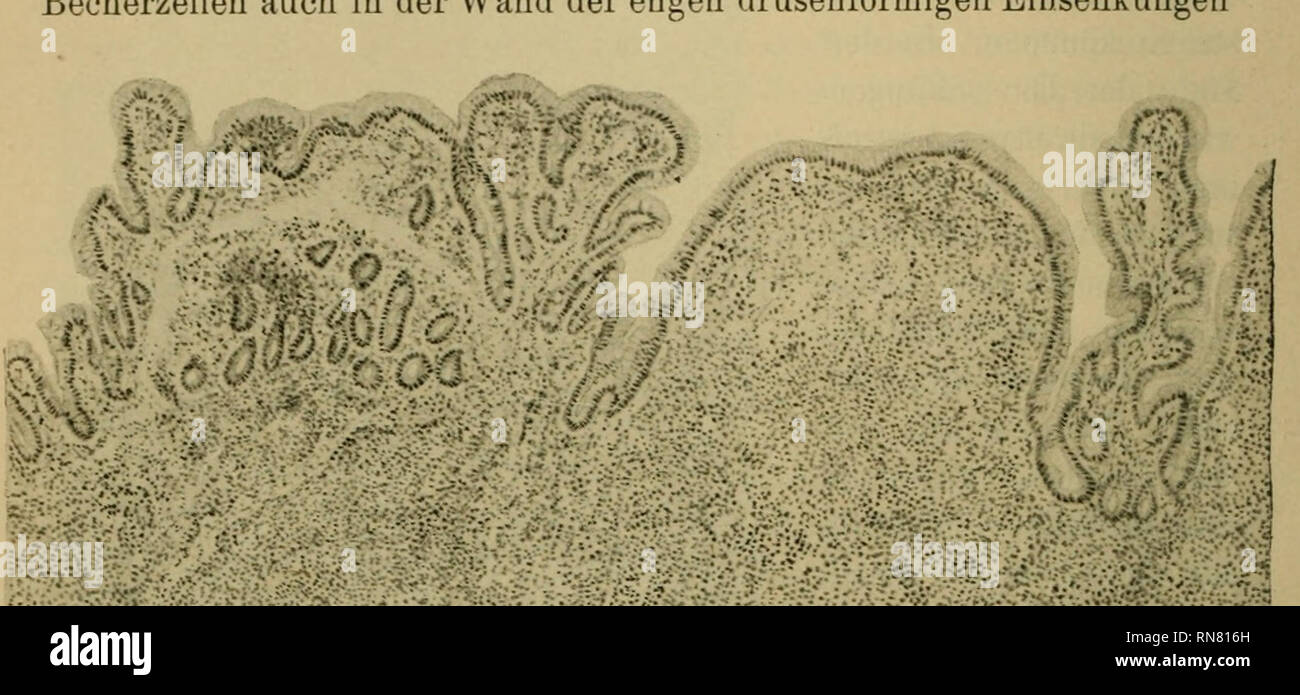 . Anatomischer Anzeiger. Anatomy, Comparative; Anatomy, Comparative. 78 ...