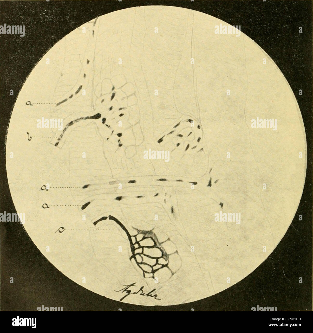 Myotonien hi-res stock photography and images - Alamy